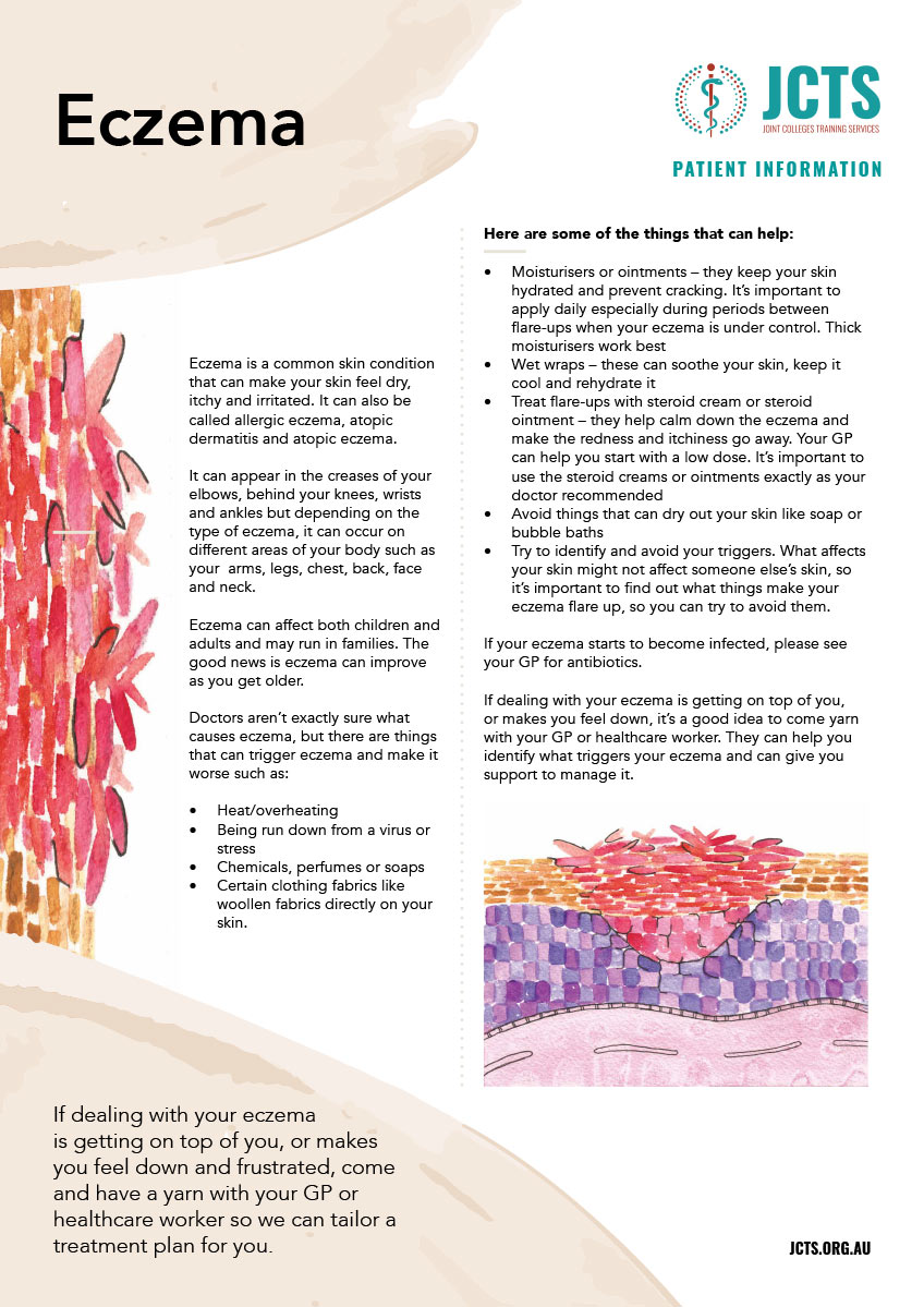 Eczema – Joint Colleges Training Services (JCTS)