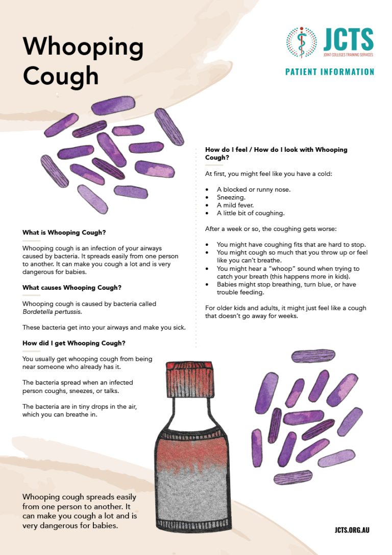 Whooping Cough - Joint Colleges Training Services (JCTS)